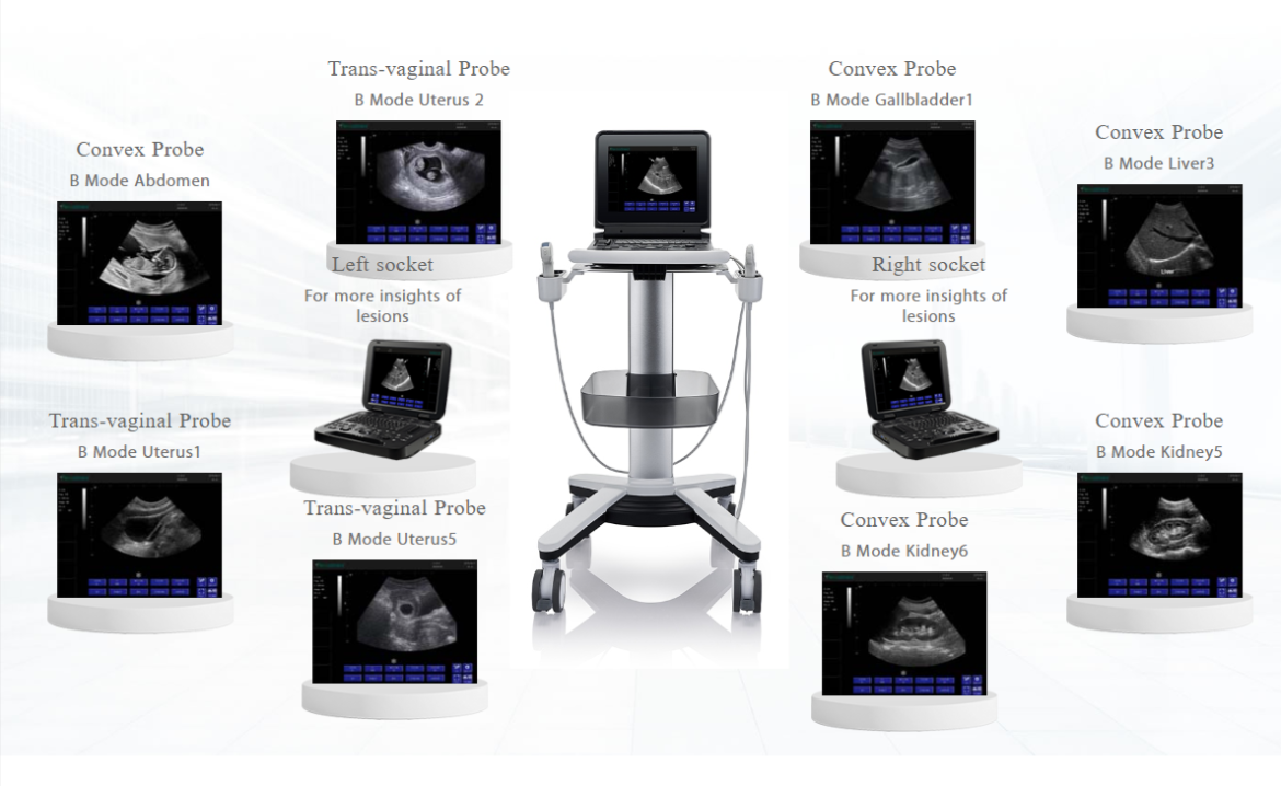Periodmed PU-DL151A Portable Ultrasound Machine | Meg Medius